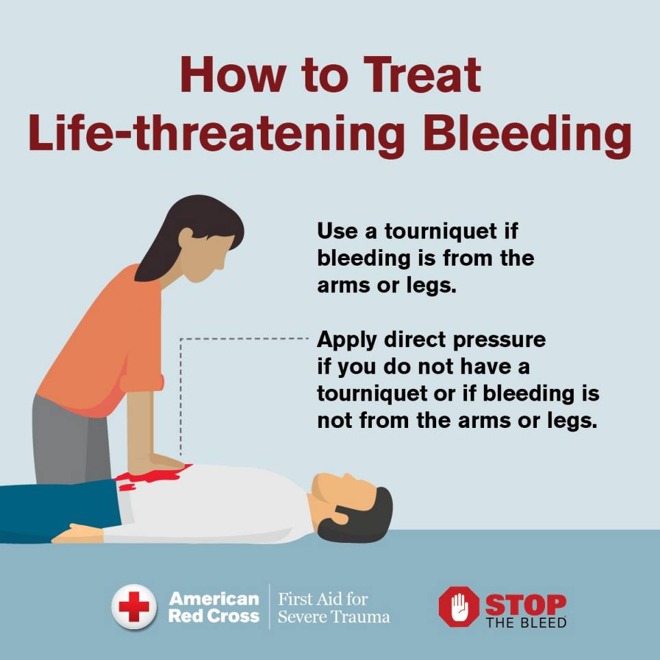 Stop the Bleed: It’s Time to Train
